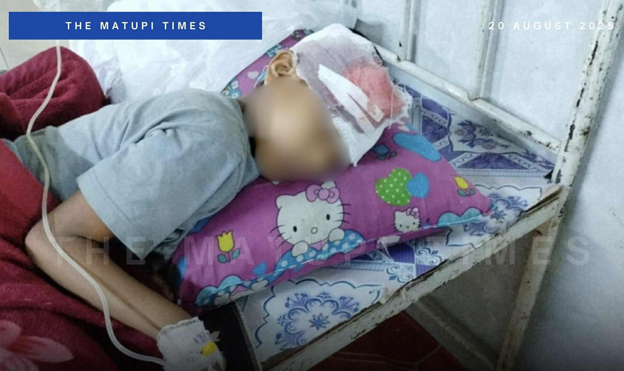 မတူပီမှာ လက်နက်ကြီးကျည်ပေါက်ကွဲမှုကြောင့် ကလေးငယ် ၄ ဦး ထိခိုက်ဒဏ်ရာရခဲ့တယ်လို့ သိရ နိုင်ငံတကာမ