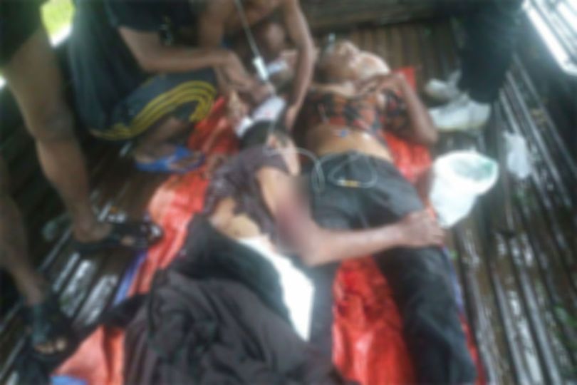 မောင်တောတွင် Arsa ပစ်ခတ်မှုကြောင့် အရပ်သား ၅ ဦးသေဆုံး၊ ၂ ဦးဒဏ်ရာရ နိုင်ငံတကာမြန်မာ့သတင်း